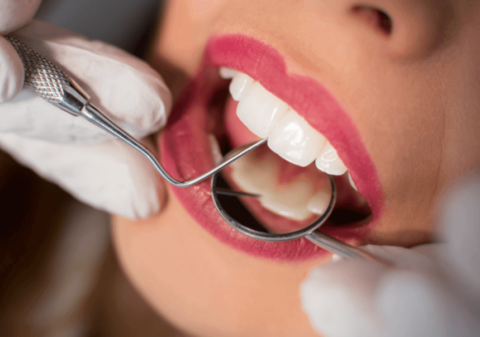 Periodontitis Apical Málaga |Aguda, Crónica, Supurativa| Qué es