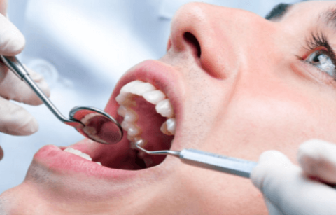 Periodontitis Apical Málaga |Aguda, Crónica, Supurativa| Qué es